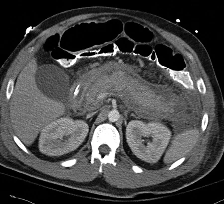 Gastroenterologi – Doctors In Sweden